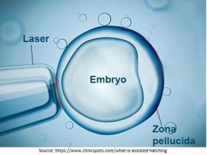 Assisted Hatching Treatment in Ahmedabad | Nisha IVF Centre
